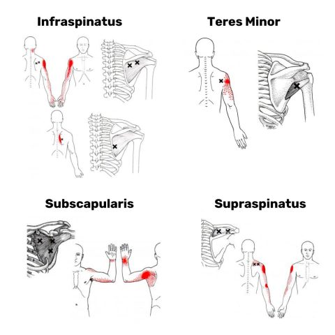 Referred Pain – The Rotator Cuff - Kamloops Physiotherapy